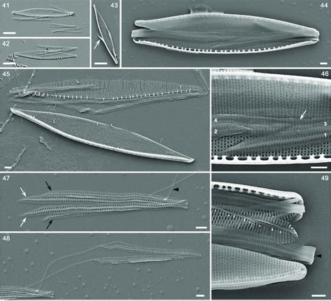 Girdle Structure In Nitzschia Captiva Sp Nov Sem Except Figs 41 Download Scientific