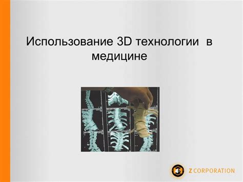 Презентация Использование 3d технологии в медицине скачать проект