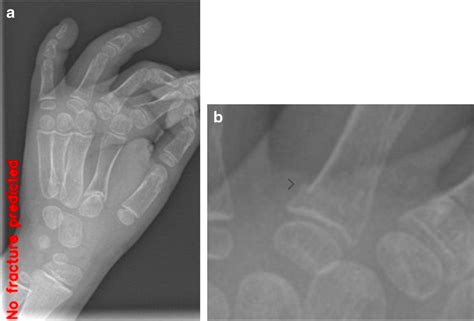 A An Example Of A False Negative Prediction Made By The Algorithm On An