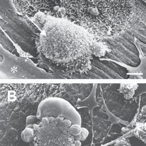 Pdf Scanning Electron Microscopy Of Bone
