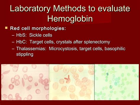 Interpreting Abnormal Hemoglobin Study Ppt