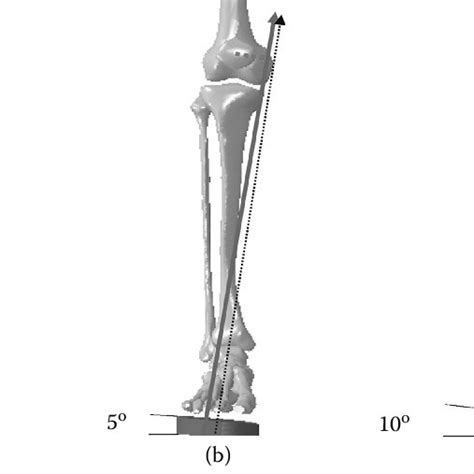1 The Lateral Medial Shift Of The Center Of Pressure And The Ground Download Scientific Diagram