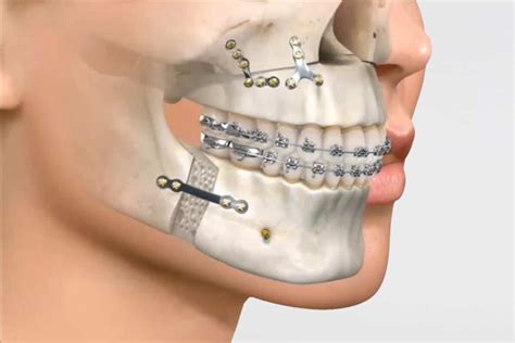 Protocol Surgery First Birbe Clinic