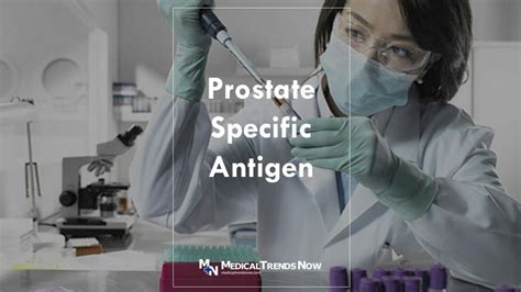 Prostate Specific Antigen Testing Is Important For Filipino Men