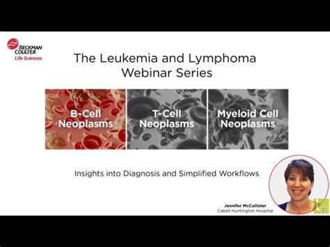 Free Video B Cell Neoplasms Insights Into Diagnosis And Simplified