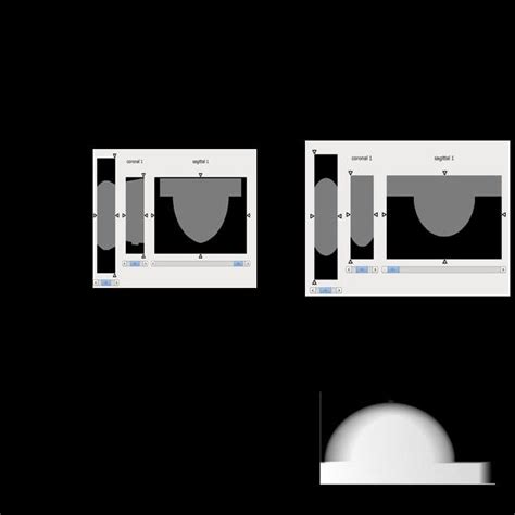 The Flowchart Of Proposed Method To Reduce Boundary Artifacts Of The Download Scientific