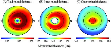 Thickness Maps Illustrating The Average Thickness Of A The Total Download Scientific Diagram