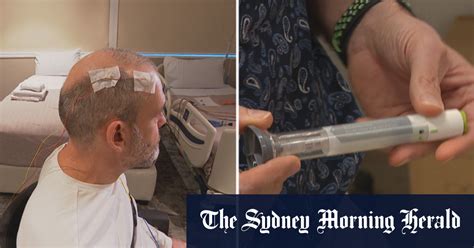 Video New Drug To Cure Obstructive Sleep Apnoea