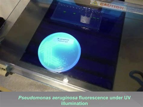 Pseudomonas 161203195049 Pdf