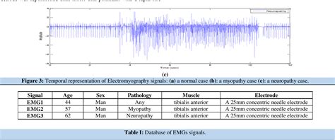 Figure 2 From Pathological Electromyogram Emg Signal Analysis
