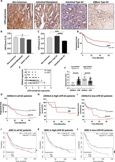 Targeting Metastasis Initiating Cancer Stem Cells In Gastric Cancer