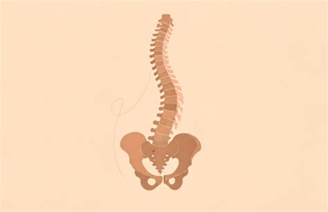 Managing Gibbus Deformity In Kyphosis And Scoliosis Treating Scoliosis