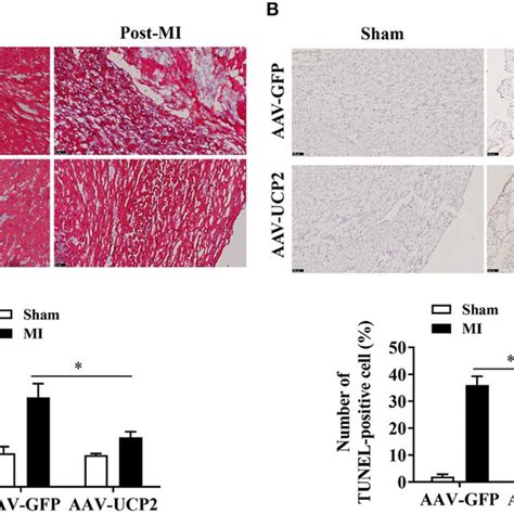 Left Ventricular Functional And Quantitative Echocardiographic Analysis Download Scientific