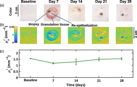 Spatial Frequency Domain Imaging A Quantitative Noninvasive Tool For In Vivo Monitoring Of