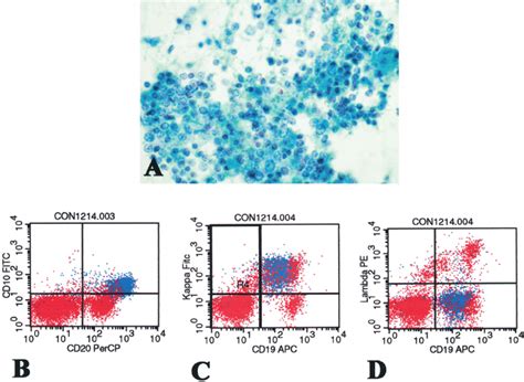 A Follicular Lymphoma A Slightly Dispersed Follicle Demonstrates A Download Scientific