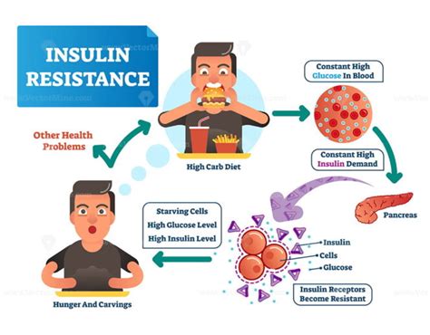 Insulin Resistance Pathological Health Condition Educational Outline Diagram Vectormine
