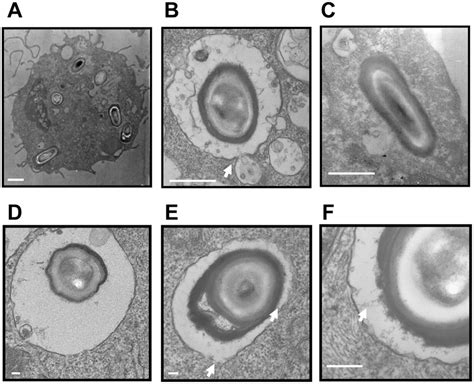 C Difficile Spores Remain Intact Inside The Phagosome Of Raw 2647