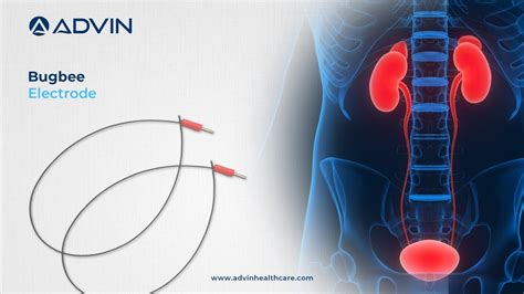 Premium Bugbee Electrode For Electrosurgical Coagulation In Urology