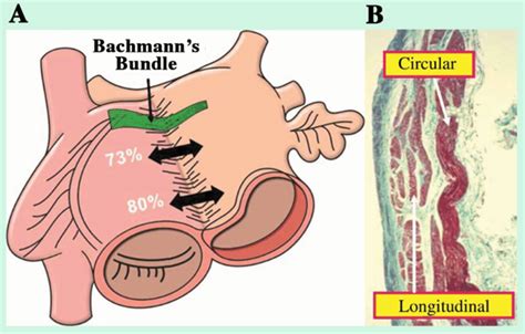 A The Illustration Shows How Bachmanns Bundle Is The Direct