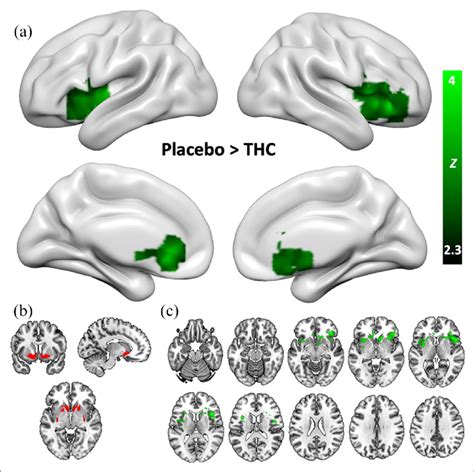 Drug Effects On Brain Wide Connectivity With The Limbic Striatum In
