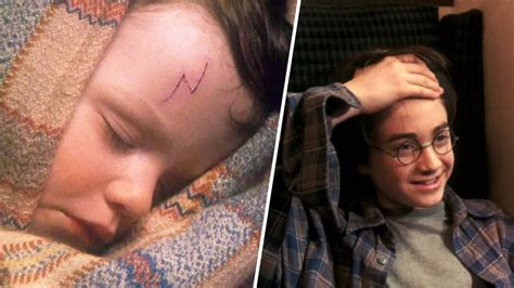 Harry Potter Fans Finally Learn Why His Scar Is Shaped Like A Lightning