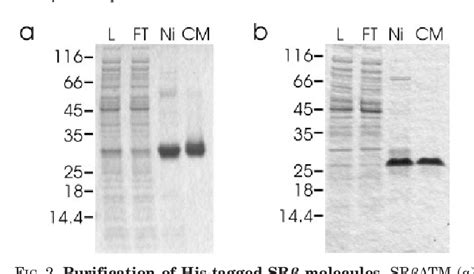 Figure 2 From The β Subunit Of The Signal Recognition Particle Receptor Is A Novel Gtp Binding
