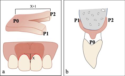 Schematic Diagram Of The Shape And Placement Of The Ctg A