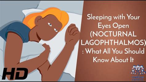 A Blinkless Slumber Unraveling The Phenomenon Of Sleeping With Eyes