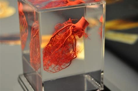 Body Worlds Rx Prescriptions For Healthy Living At The Health Museum