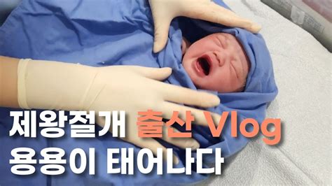 Vlog 출산 브이로그 제왕절개 생생후기 실밥터졌대요 Youtube