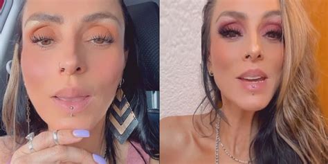 Ivonne Montero Se Asusta Con Reacción Alérgica