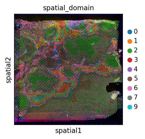 Splane Tutorial Identification Of Uniform Spatial Domain On Human Breast Cancer Visium Dataset