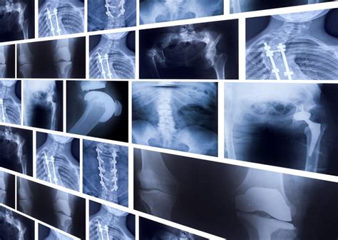 Sciatica What You Need To Know Loving Life