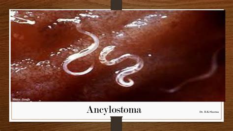 Genus Ancylostomapdf Parasitology Lecture Pdf