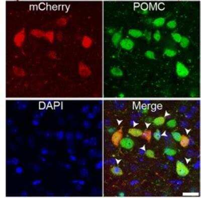 Mcherry Antibody Nbp2 25157 Novus Biologicals