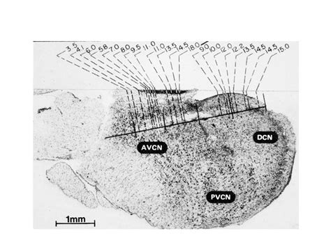 Perception Lecture Notes Auditory Pathways And Sound Localization