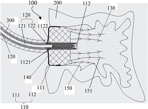Left Atrial Appendage Occlusion Device Eureka Patsnap