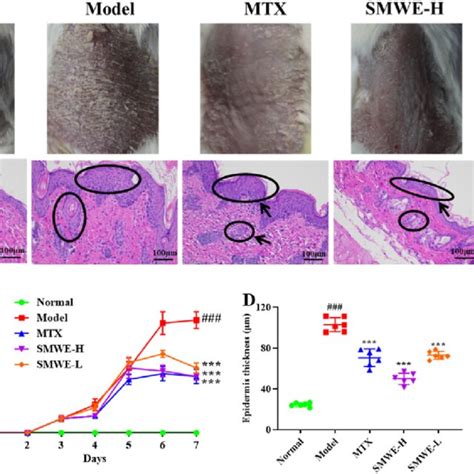 Effect Of Smwe On Imq Induced Psoriasis In Mice A Scheme Of The Download Scientific Diagram