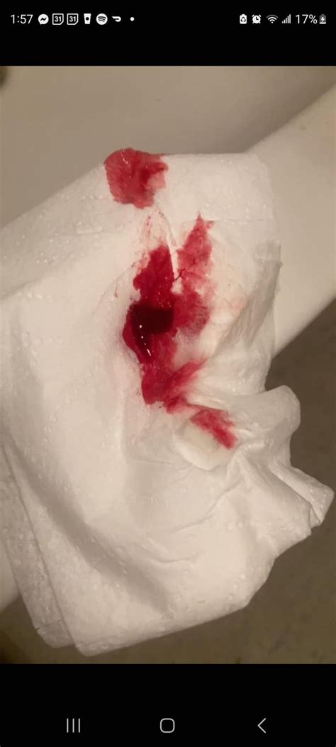 Bright Red Diarrhea With Blood
