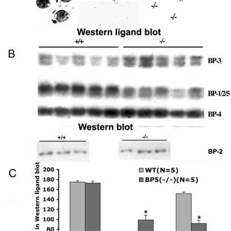 Analysis Of Igfbp Expression And Circulating Igf I Levels In Igfbp 5 Ko