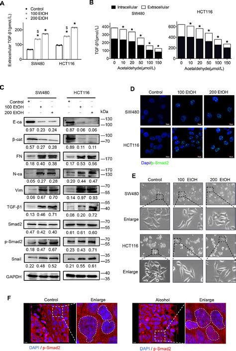 ethanol promotes alcohol related colorectal cancer metastasis via the