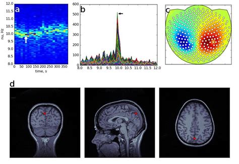 a the spectrogram calculated in 15 second time window time moment