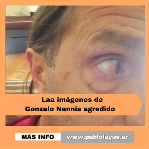 Las Imágenes De Gonzalo Nannis Agredido Pablo Layús