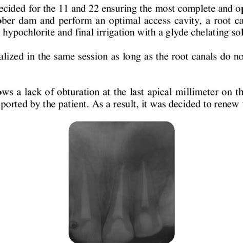 Prot Operative Retro Alveolar Radiograph Showing The Rct On 11 21
