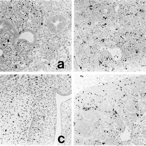 Pyknotic Cells In The Lung A Liver B Craniofacial Tissue C And