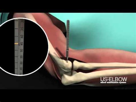 Ijs Elbow Animation By Skeletal Dynamics Youtube