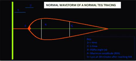 Normal Schematic Representation Of A Thromboelastogram Download