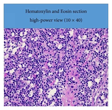 Hematoxylin And Eosin Stain Light Microscopy 10 × 40 A 10 × 40 B