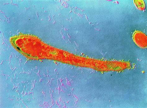 Actinomyces Israelii Bacterium By Cnri Science Photo Library