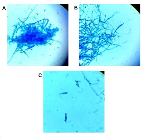 Microscopic Examination Of Lpcb Stained Dermatophyte Identified As